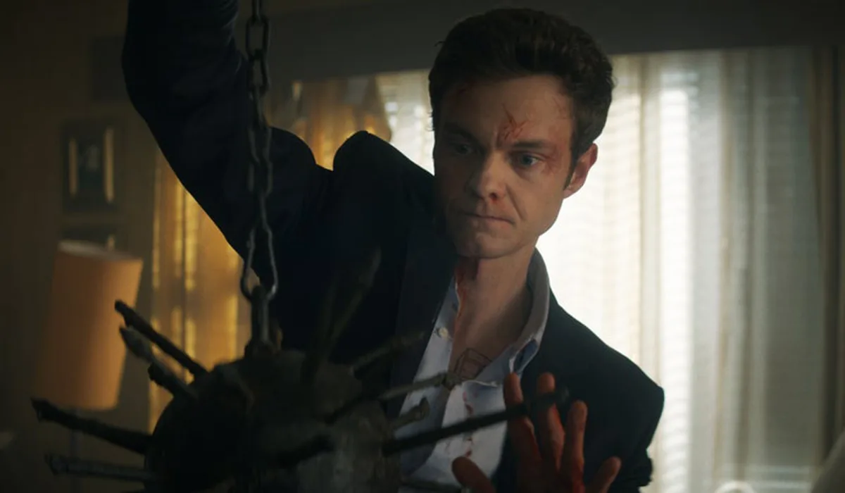 "Novocaine", el amor duele... ¿o no? | UB